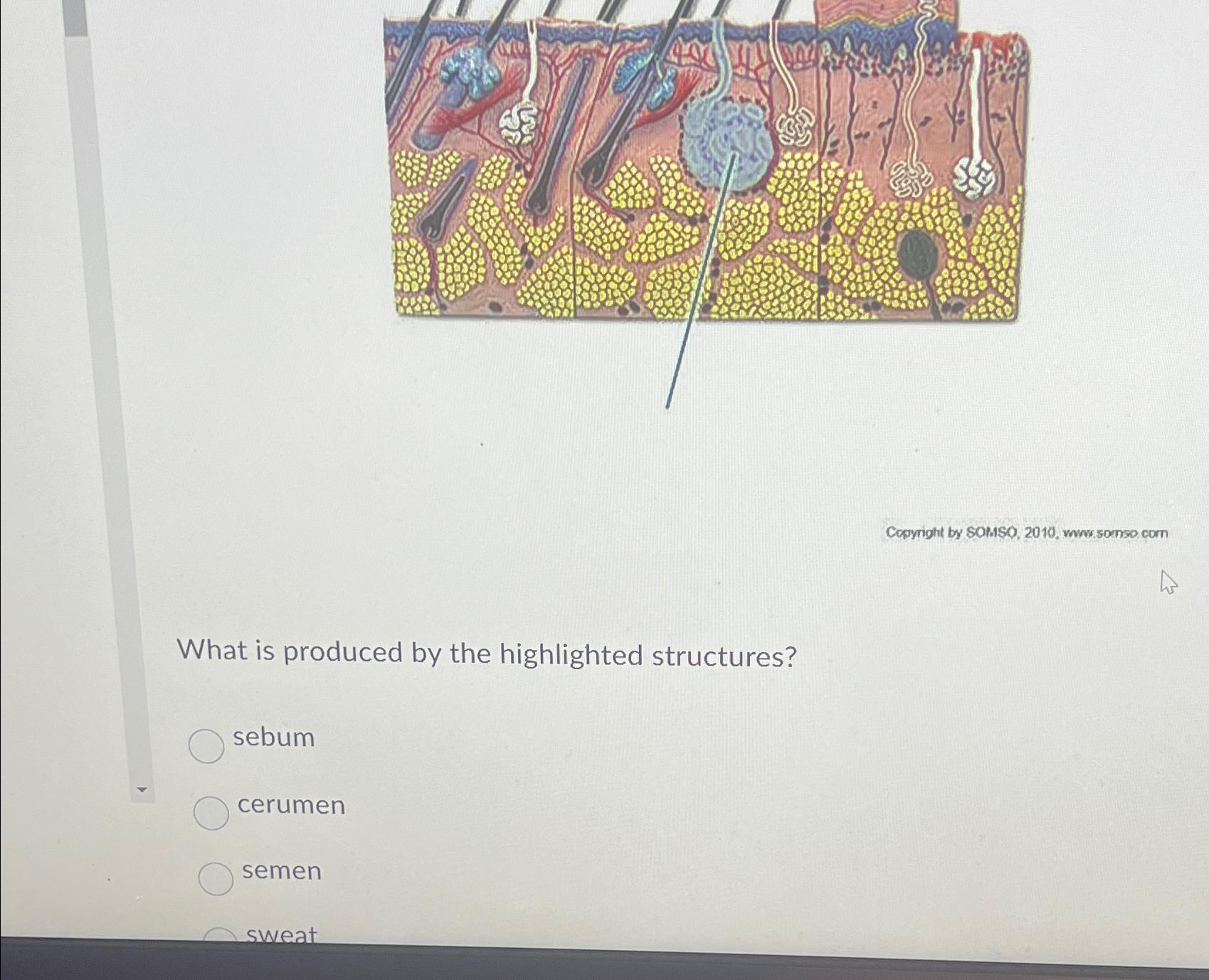 Solved Copynitht by SOMSO, 2010, ﻿www somso comWhat is | Chegg.com