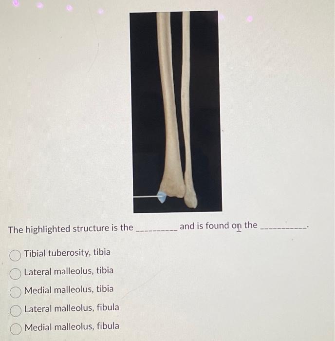 Solved The highlighted structure is the Tibial tuberosity, | Chegg.com