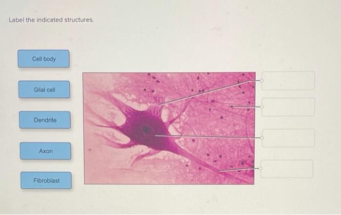 Solved Identify the following tissue in the micrograph and | Chegg.com