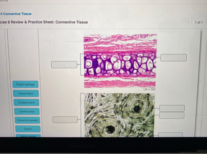 Solved Il Connective Tissue cise 8 Review & Practice Sheet: | Chegg.com