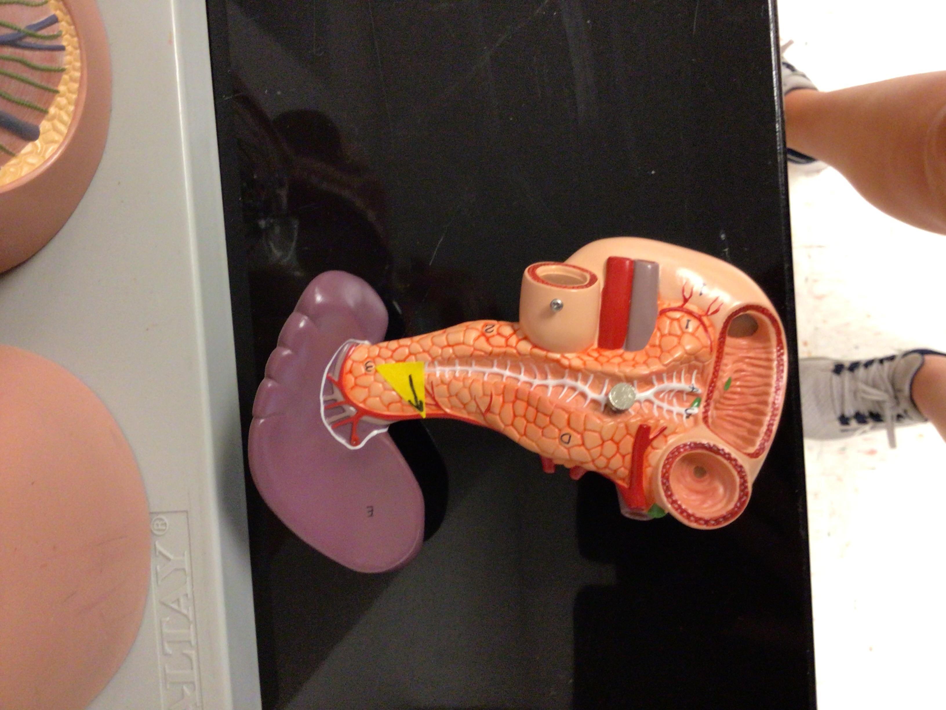 Solved what artery is the yellow arrow pointing at? | Chegg.com