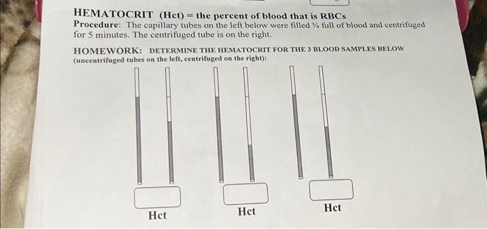 Solved HEMATOCRIT (Het) = the percent of blood that is RBCs | Chegg.com