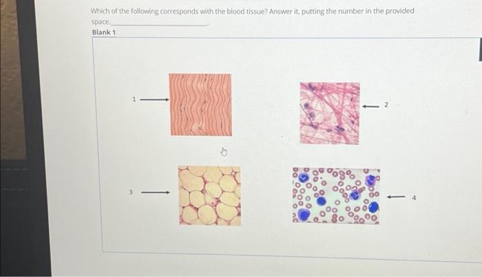Solved Which of the following corresponds with the blood | Chegg.com