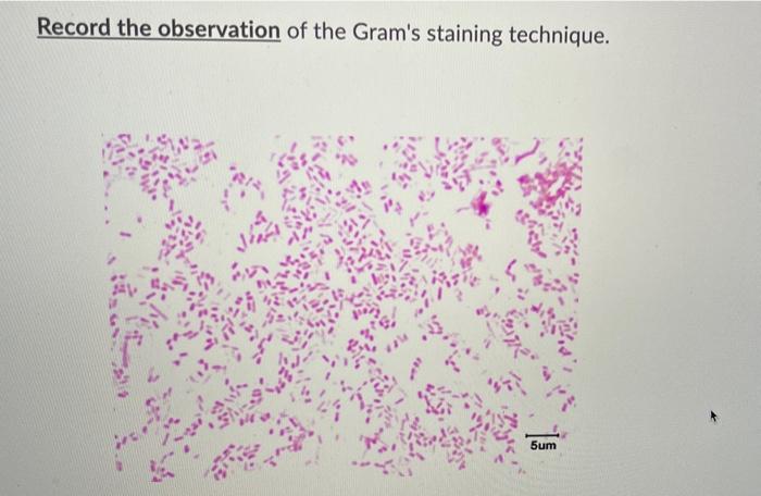 Solved Phenol red broth test is shown in the figure below. | Chegg.com