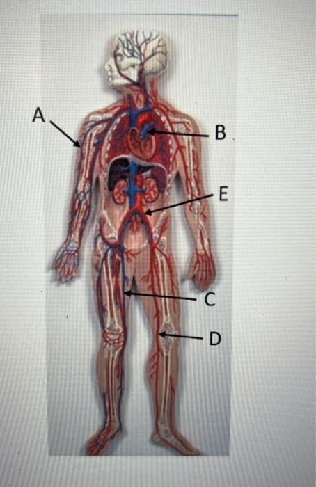 Solved label the arteries | Chegg.com
