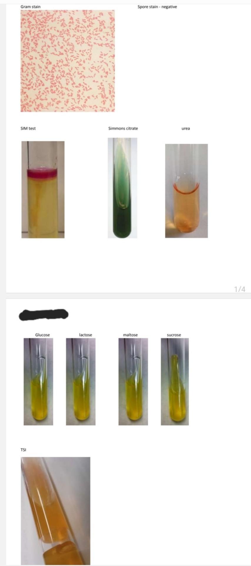 MSA plate (no growth) SA MacConkey plate (growth) EMB | Chegg.com