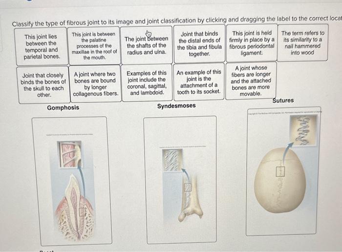 Solved Classify the type of fibrous joint to its image and | Chegg.com