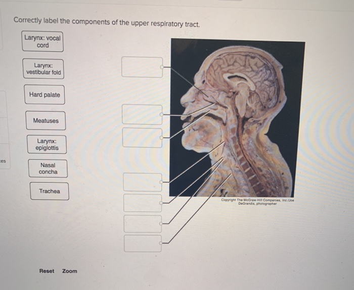 Solved Correctly label the components of the upper | Chegg.com
