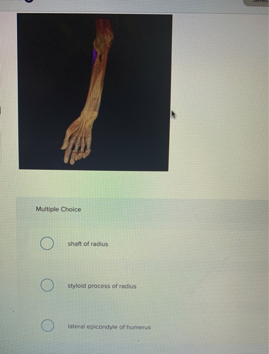 Solved Multiple Choice shaft of radius styloid process of | Chegg.com