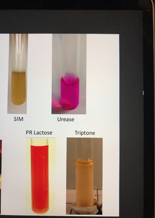 Solved @ Q Search 23 Mac KIA SIM Urease Gram stain Streak on | Chegg.com
