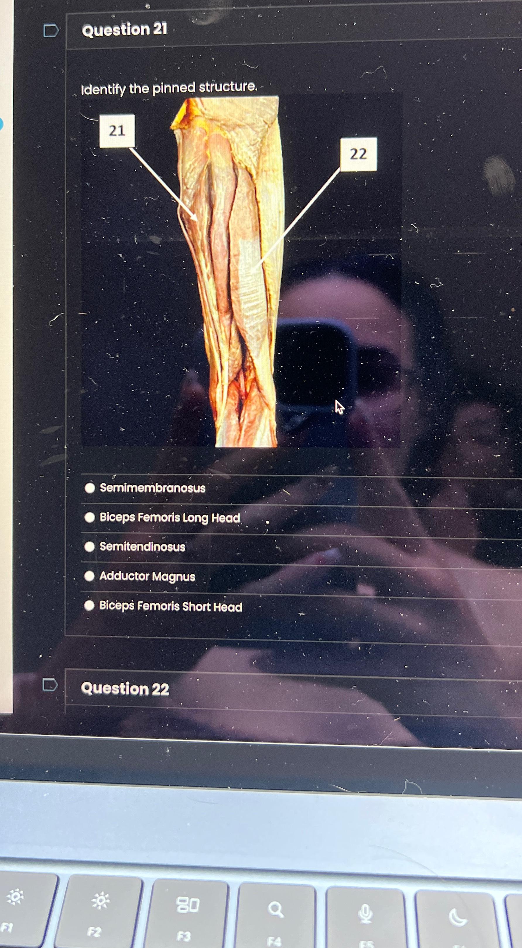 Solved Question 21Identify the pinned | Chegg.com