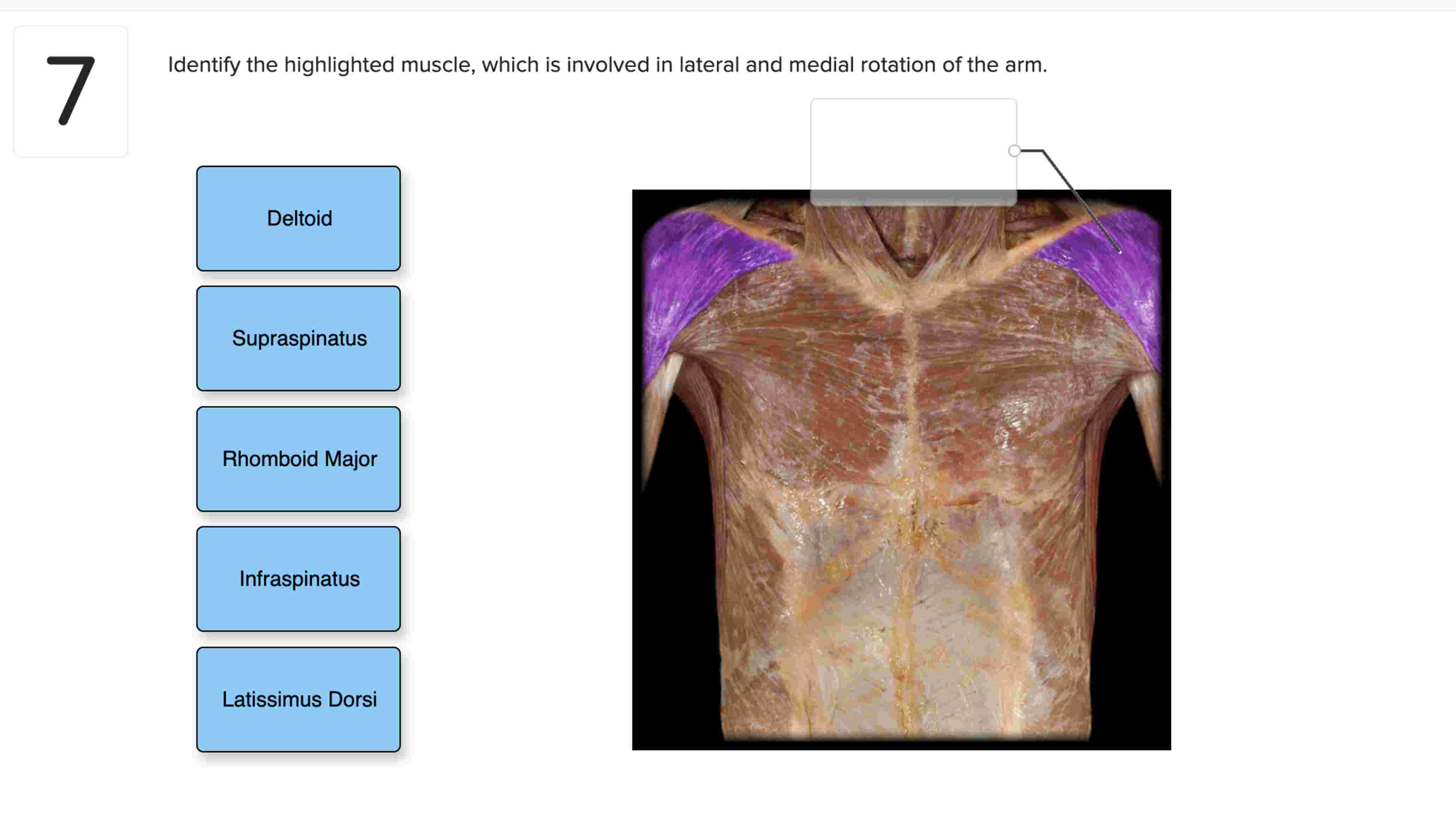 Solved 7Identify the highlighted muscle, which is involved | Chegg.com