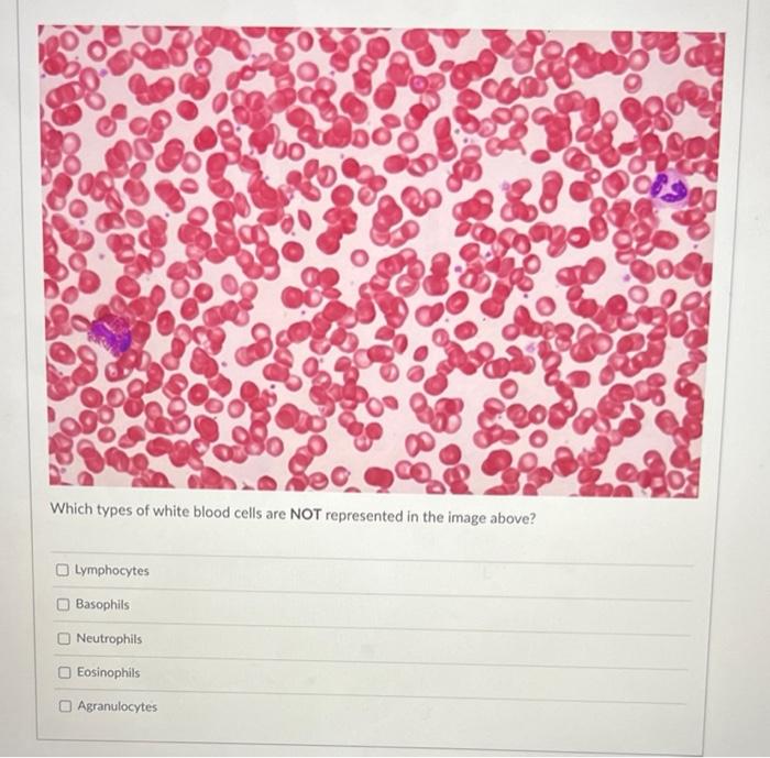 Which zone of a blood smear is best for the | Chegg.com