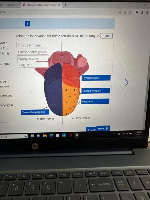 Solved Label the innervation for these certain areas of the | Chegg.com