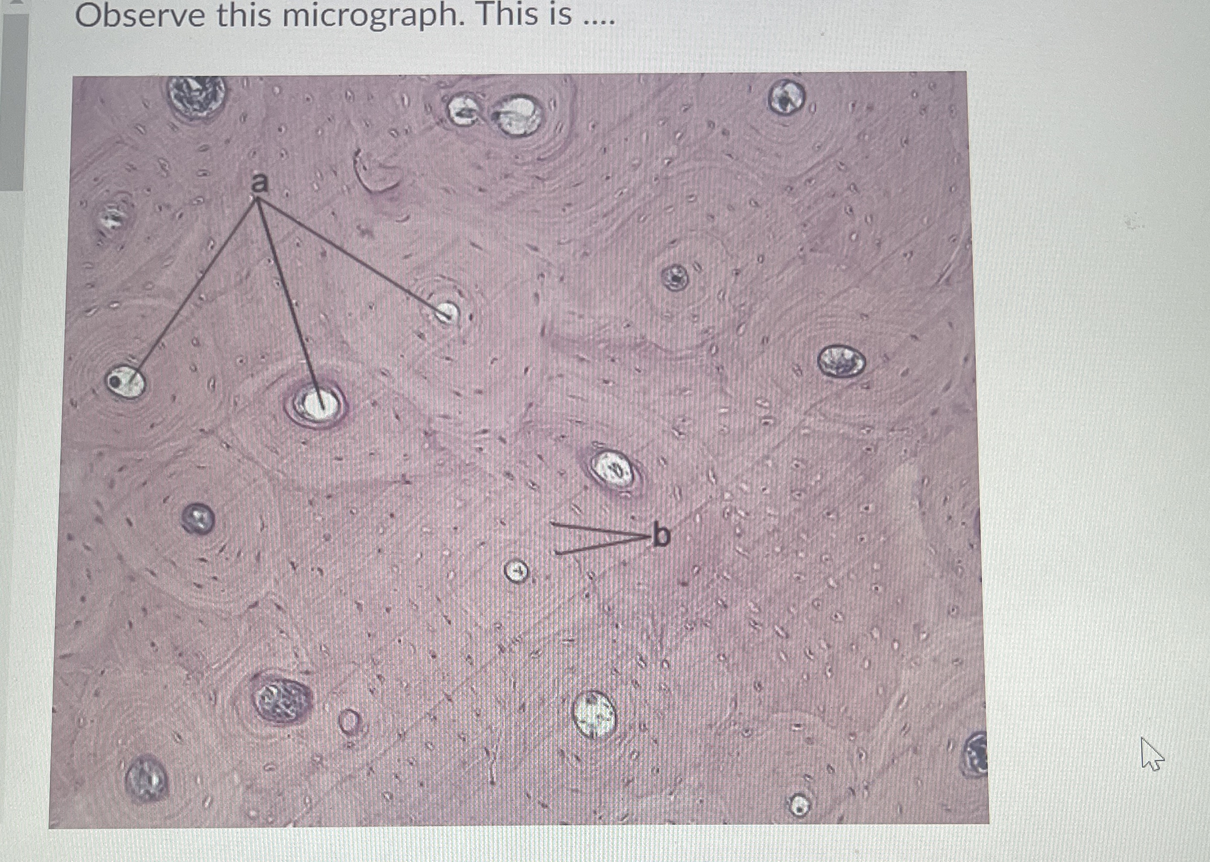 Solved Observe this micrograph. This is .... | Chegg.com