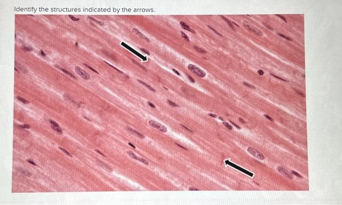 Solved Identifv the structures indicated bv the | Chegg.com