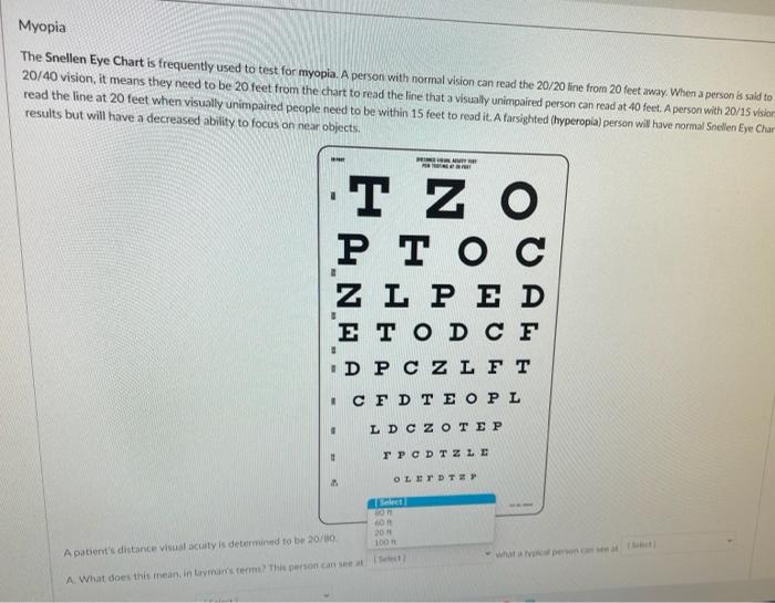 Solved The Snellen Eye Chart is frequently used to test for | Chegg.com