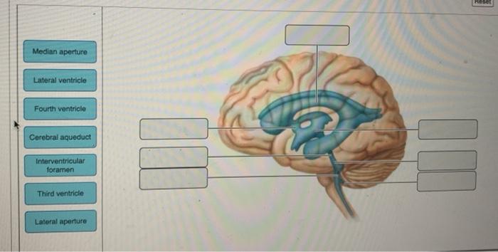 Solved haser Median aperture Lateral ventricle Fourth | Chegg.com