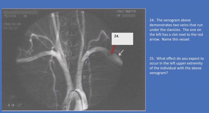 Solved 24. The venogram above demonstrates two veins that | Chegg.com