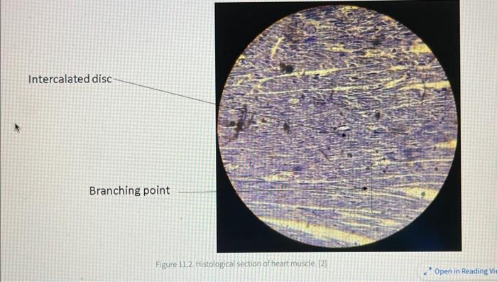Solved Examine the following image of the histology of | Chegg.com