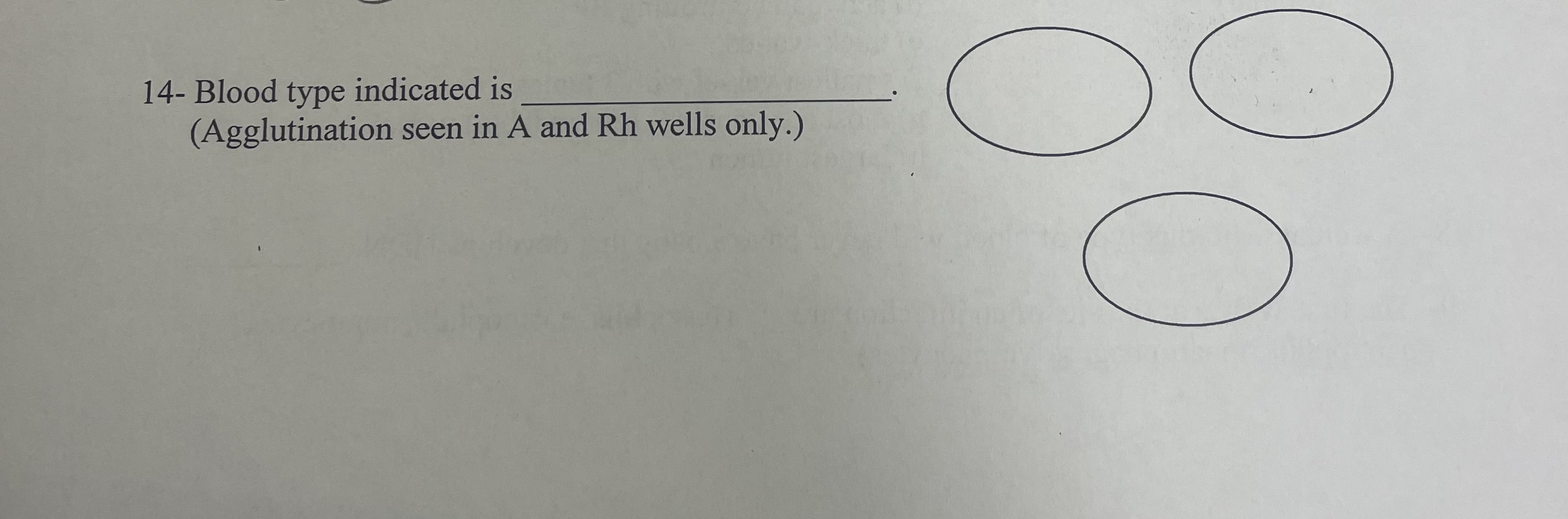 Solved 14- ﻿Blood type indicated is(Agglutination seen in A | Chegg.com