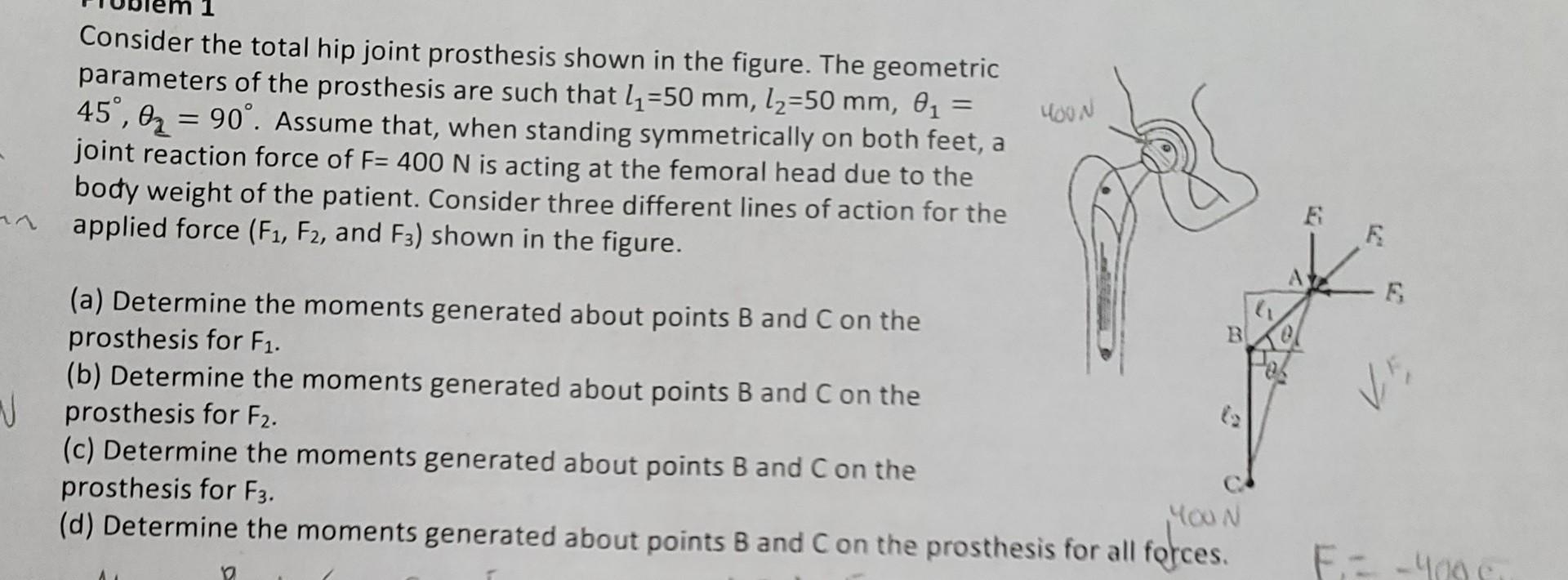 Solved Consider the total hip joint prosthesis shown in the | Chegg.com