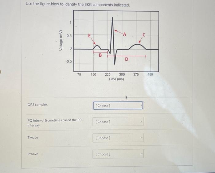 Solved Use the figure blow to identify the EKG components | Chegg.com