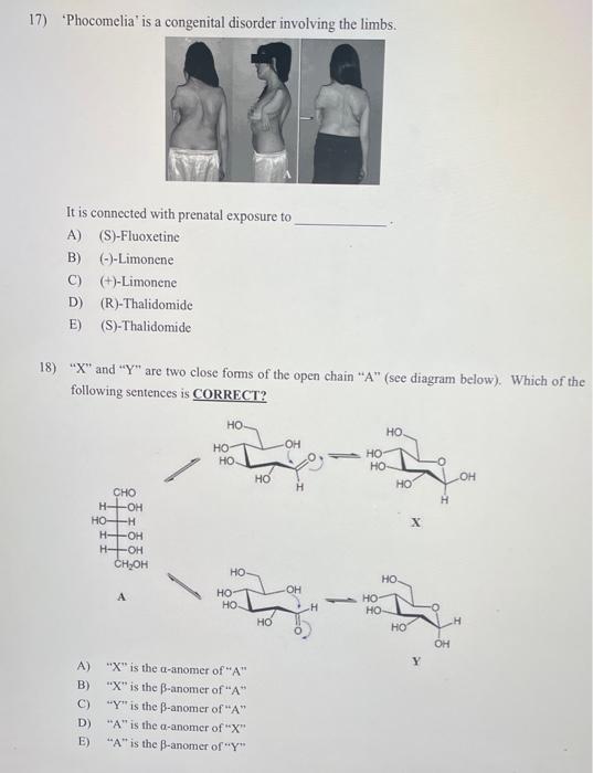 Solved 17) Phocomelia' is a congenital disorder involving | Chegg.com