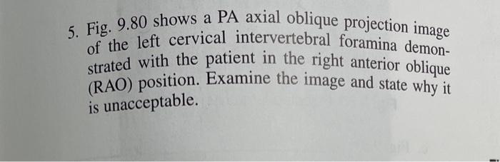 Solved 5. Fig. 9.80 shows a PA axial oblique projection | Chegg.com