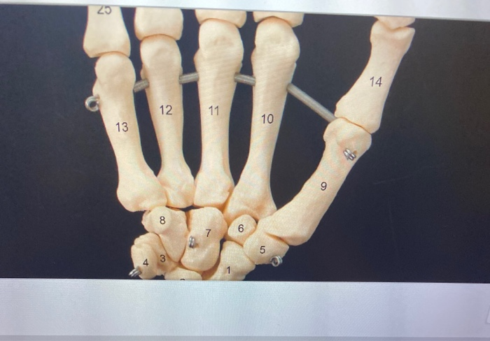 Solved 2 The bone indicated by tag #12 is a metacarpal. The | Chegg.com