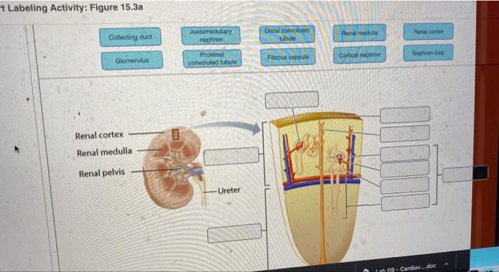 Solved t Labeling Activity: Figure 15.3a Juxtamedullary | Chegg.com