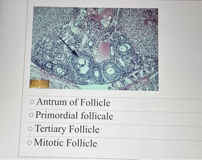 Solved Antrum of Follicle Primordial follicale Tertiary | Chegg.com