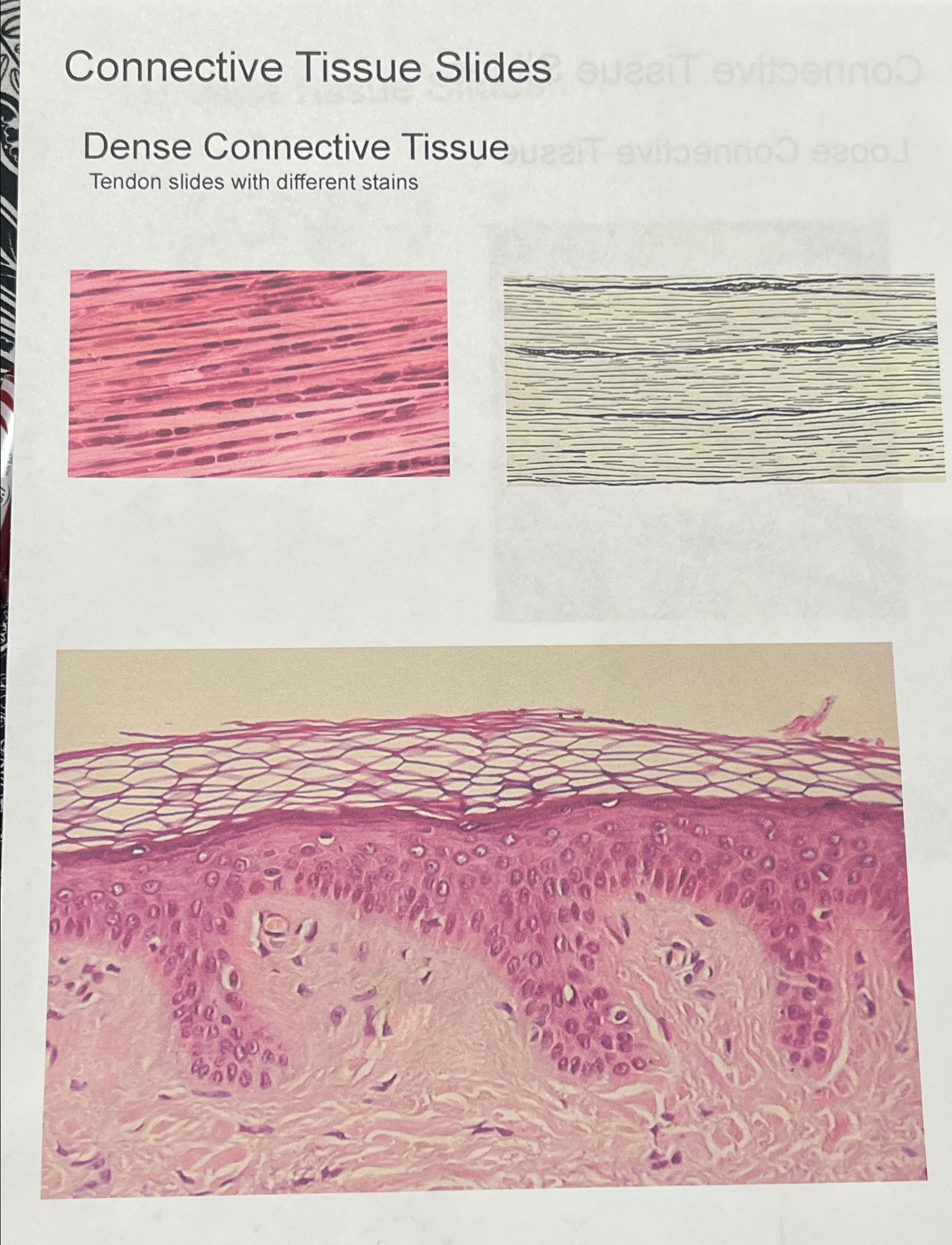 Solved Connective Tissue SlidesDense Connective TissueTendon | Chegg.com