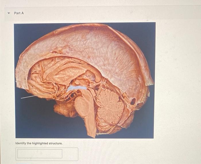 Solved Identify the highlighted structure. | Chegg.com
