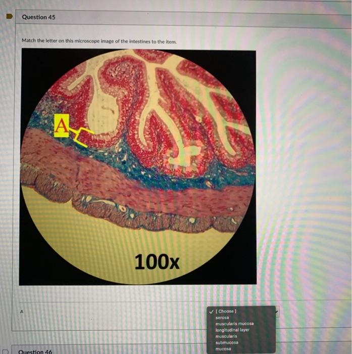 Solved Question 45 Match the letter on this microscope image | Chegg.com