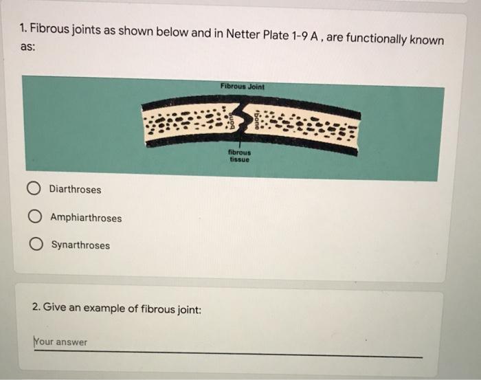 Solved 1. Fibrous joints as shown below and in Netter Plate | Chegg.com