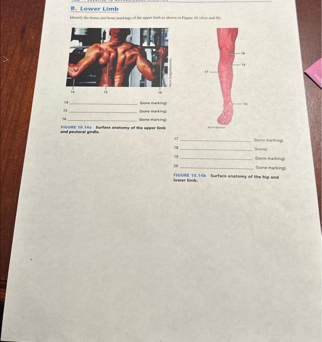 Solved ISentify the bones and bone marking of the opper limb | Chegg.com