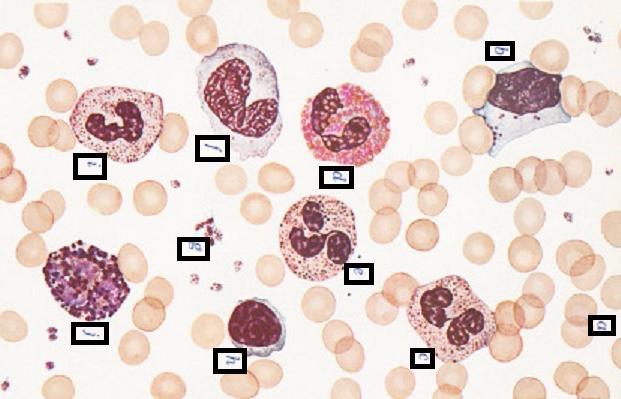 Solved Circle and label the corresponding letter for the | Chegg.com