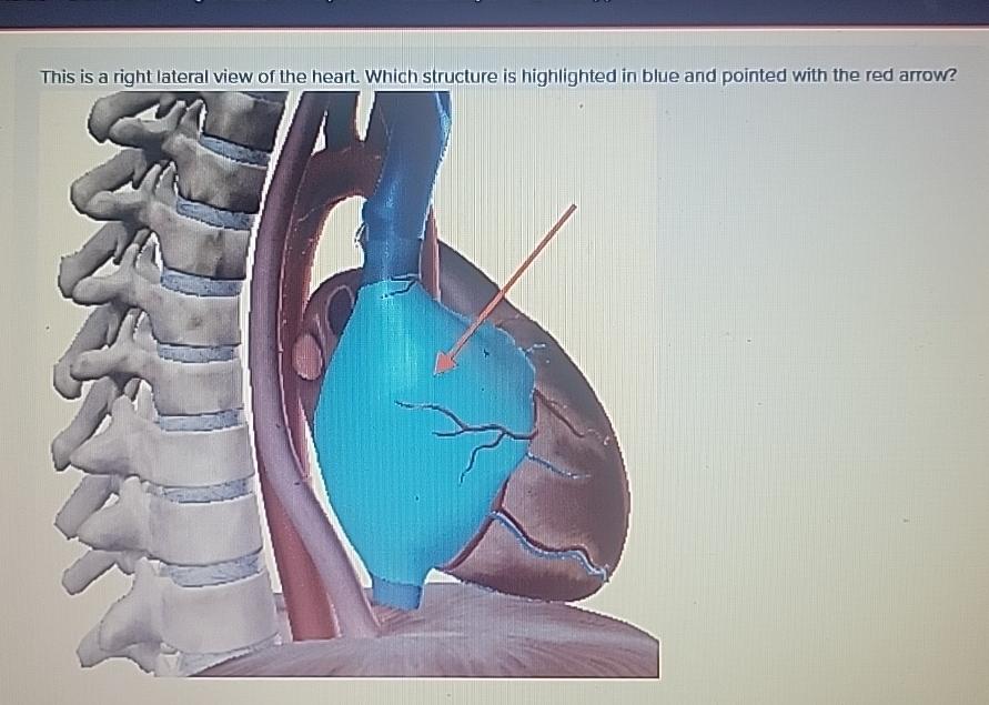 Solved This is a right lateral view of the heart. Which | Chegg.com