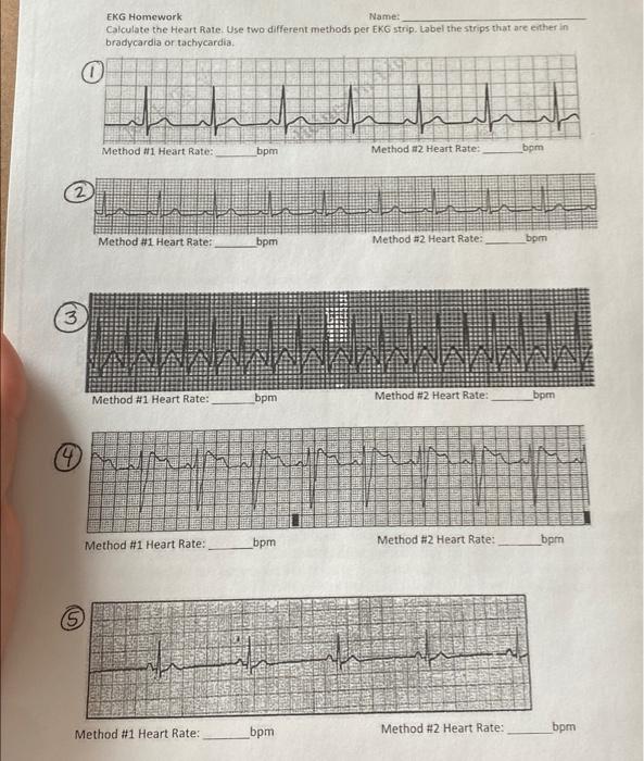 Solved EKG Homework: Calculate the Heart Rate. Use two | Chegg.com