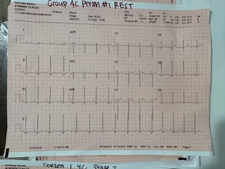 Solved 1. ﻿Is the rhythm regular or irregular?2. ﻿Determine | Chegg.com