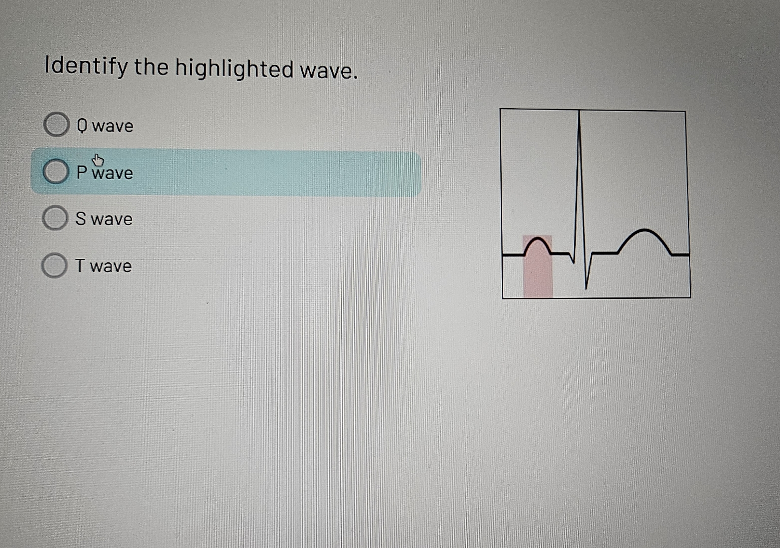Solved Identify the highlighted wave.Q waveP waveS waveT | Chegg.com