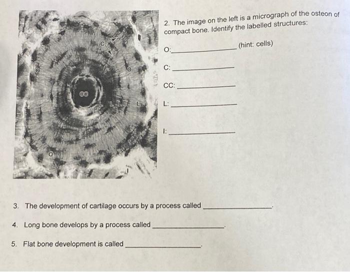 Solved 2. The image on the left is a micrograph of the | Chegg.com