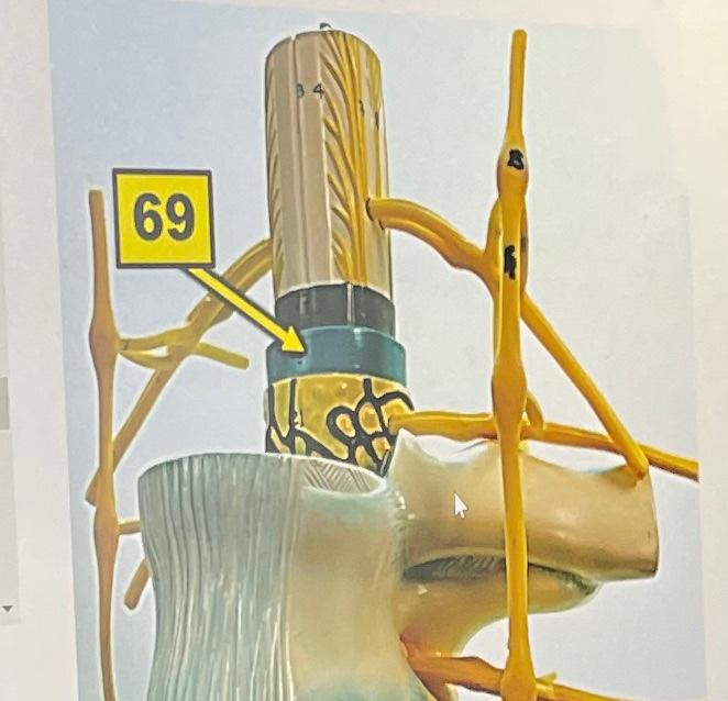 Solved identify 69 | Chegg.com