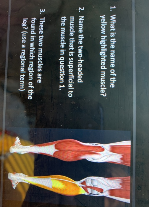 Solved 1. What is the name of the yellow highlighted muscle? | Chegg.com