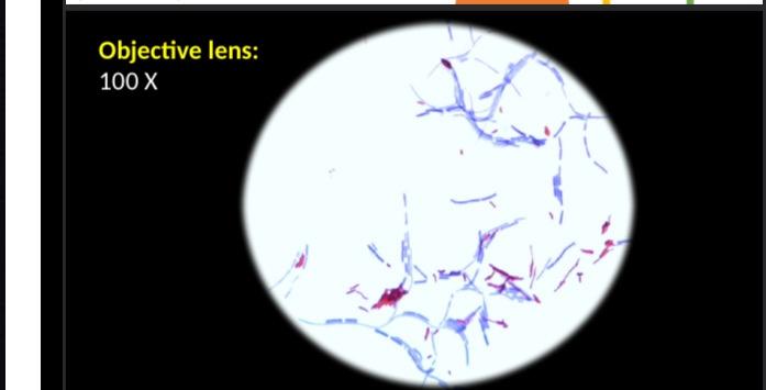 Solved Objective lens: 100X | Chegg.com