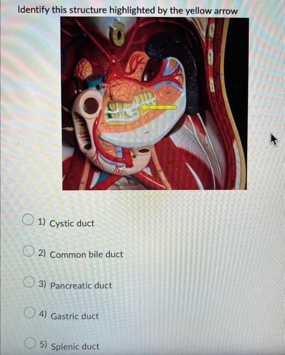 Solved Identify this structure highlighted by the yellow | Chegg.com