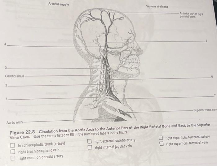 Solved 3 Carotid sinus 2. 1 Aortic arch Arterial supply | Chegg.com