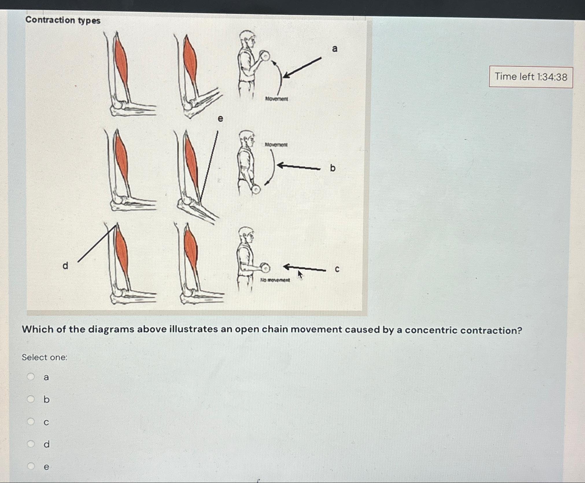 Solved Contraction typesaTime left 1:34:38dbcWhich of the | Chegg.com