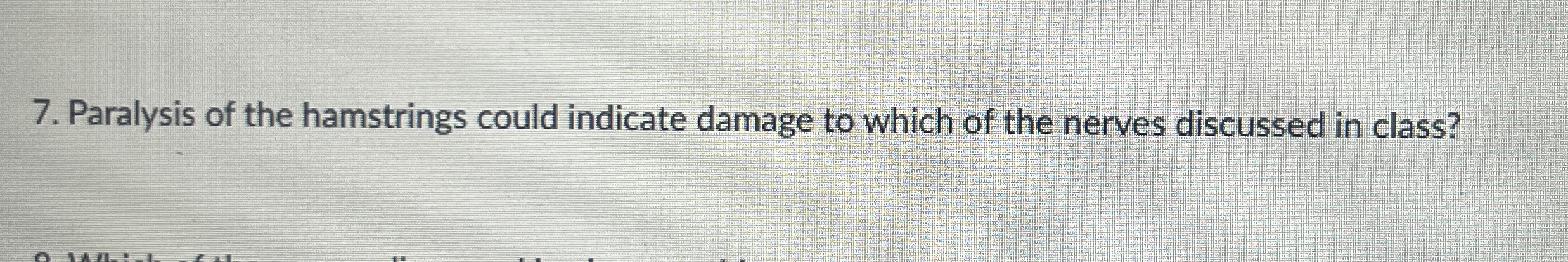 Solved Paralysis of the hamstrings could indicate damage to | Chegg.com